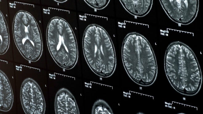 Area of Focus: Mind and Brain | Biomedical and Health Sciences ...